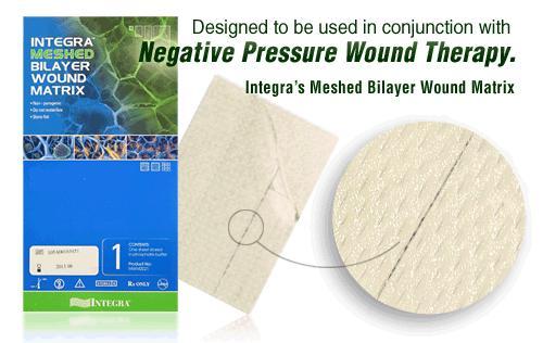 Integra BMW2021 Bilayer Matrix Wound Dressing 2 X 2 Inch – Better Life Mart